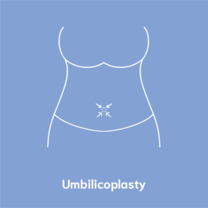 Umbilicoplasty - MD. José Cortés